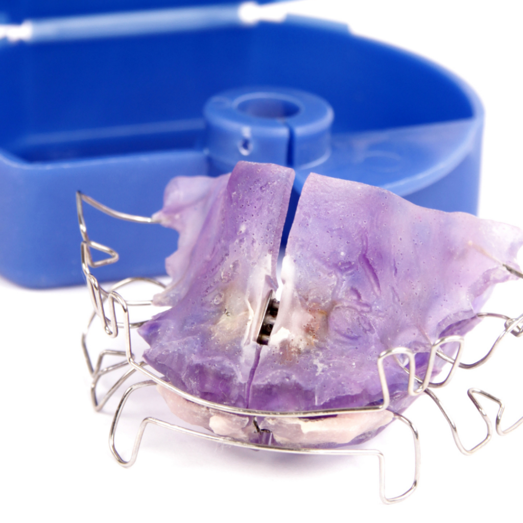 Orthodontic Treatment For Severe Cases - Blackburn Orthodontics